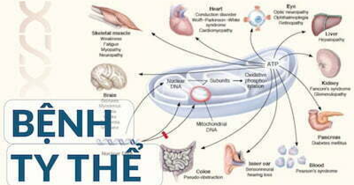 Hội chứng Klinefelter (47,XXY) - Gene Solutions Việt Nam